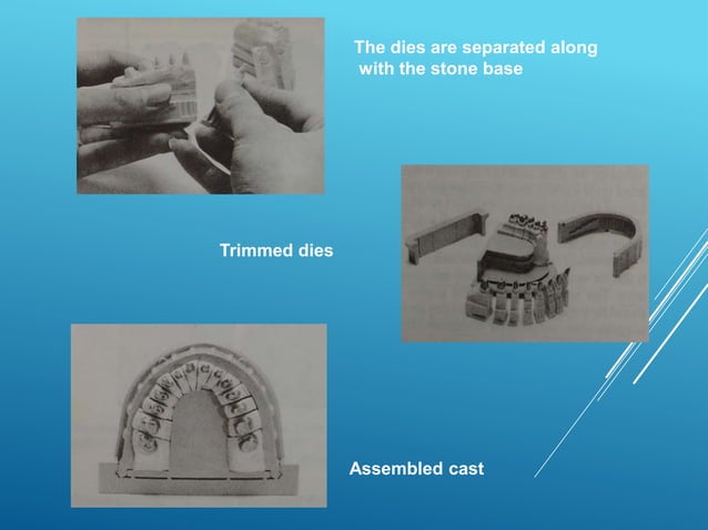 DIE SYSTEMS and die material in dentistry | PPTX | Oral care | Personal ...
