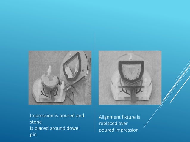 DIE SYSTEMS and die material in dentistry | PPTX | Oral care | Personal ...