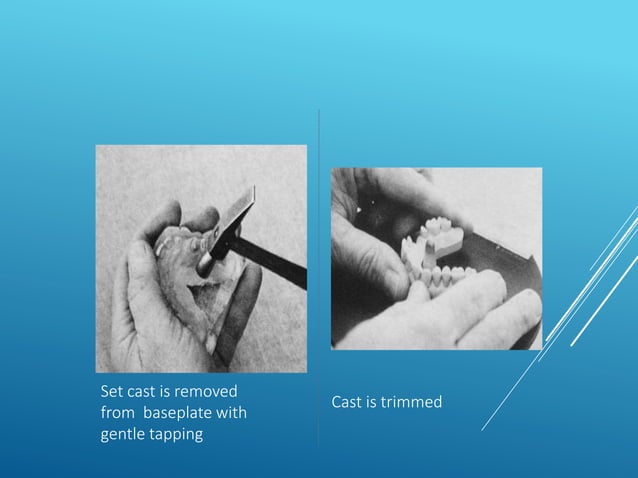 DIE SYSTEMS and die material in dentistry | PPTX | Oral care | Personal ...