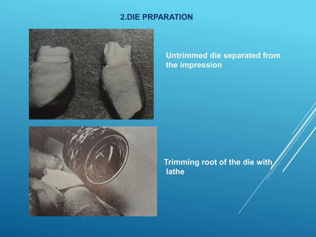DIE SYSTEMS and die material in dentistry | PPTX | Oral care | Personal ...