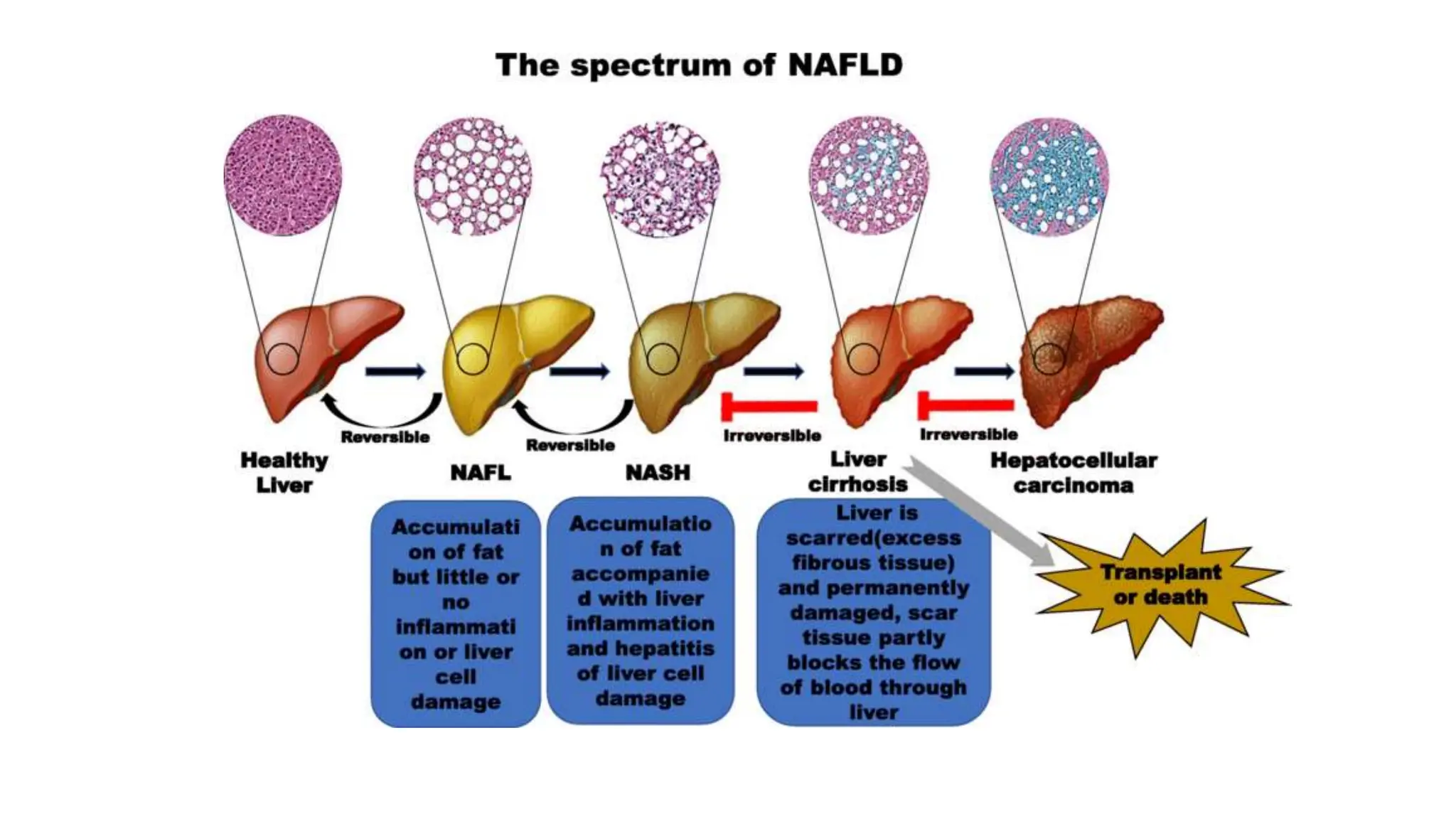 Diet and NAFLD.pptx dieatry interventions fatty liver disease | PPTX