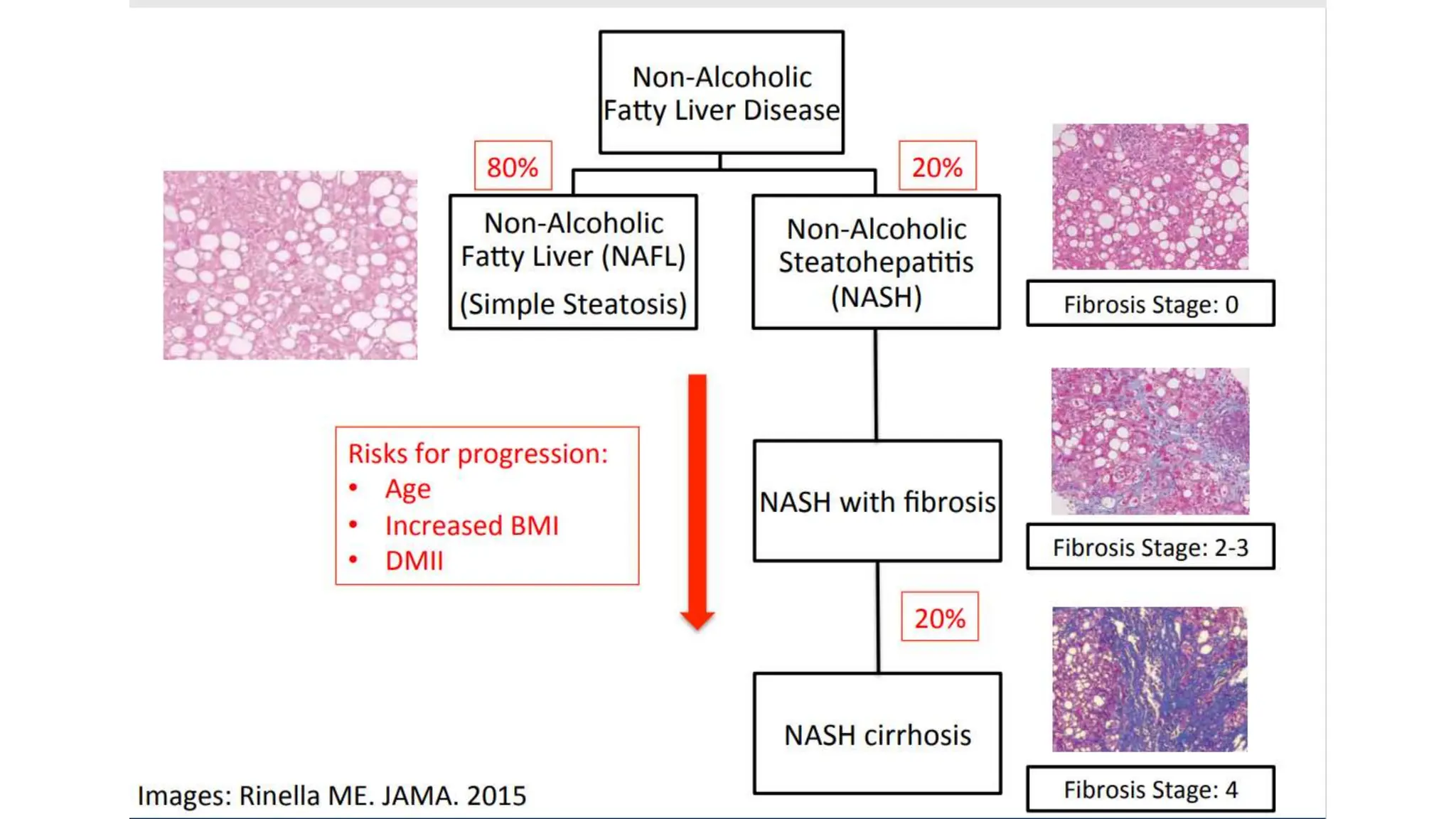 Diet and NAFLD.pptx dieatry interventions fatty liver disease | PPTX