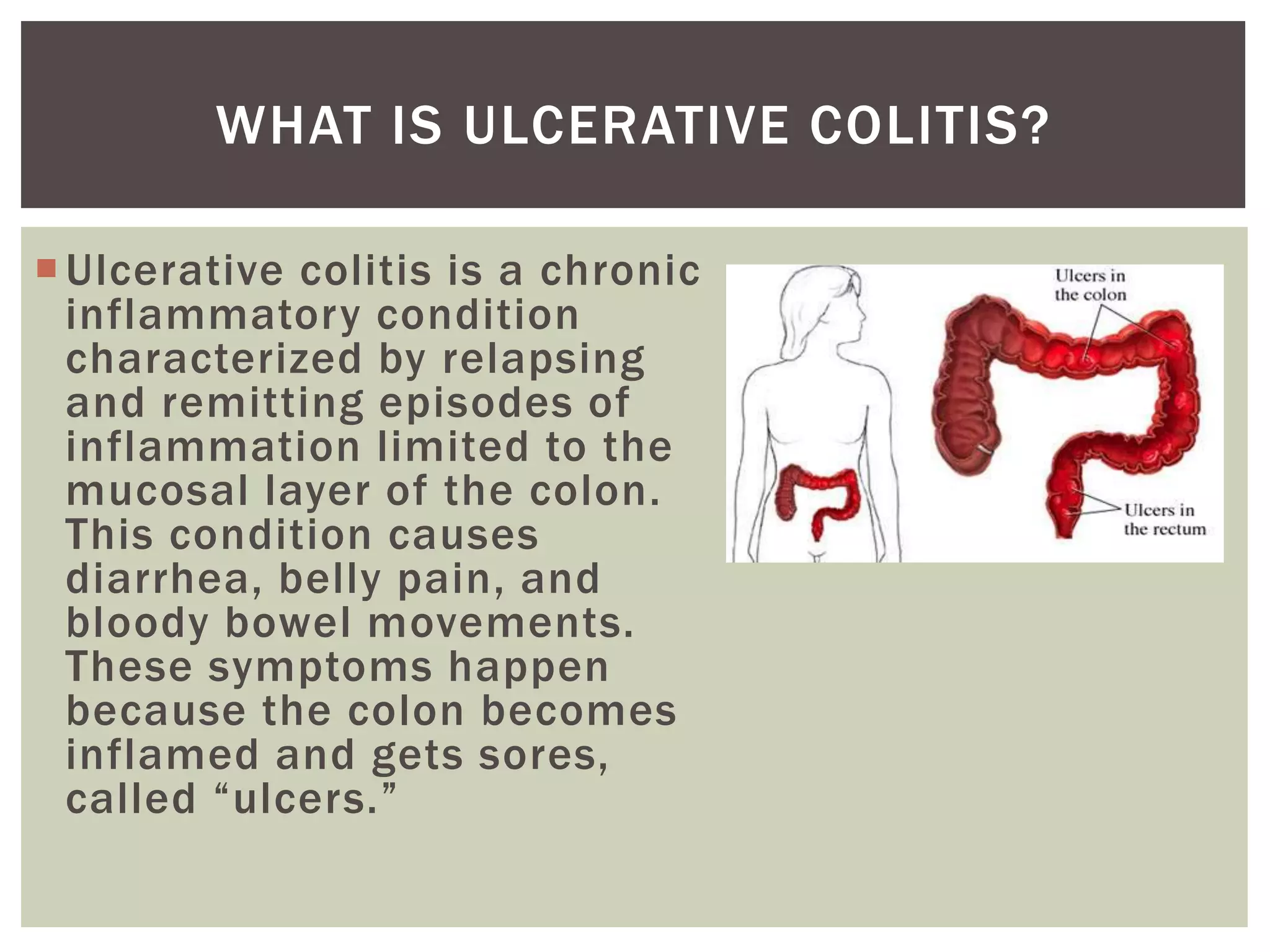 Dietary management of gastrointestinal diseases (ulcerative colitis) | PPTX