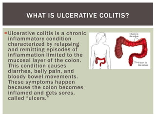 Dietary management of gastrointestinal diseases (ulcerative colitis) | PPT