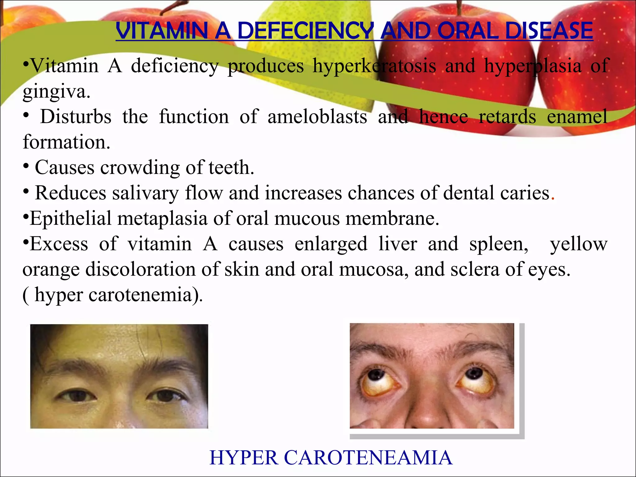 Diet and nutrition | PPT