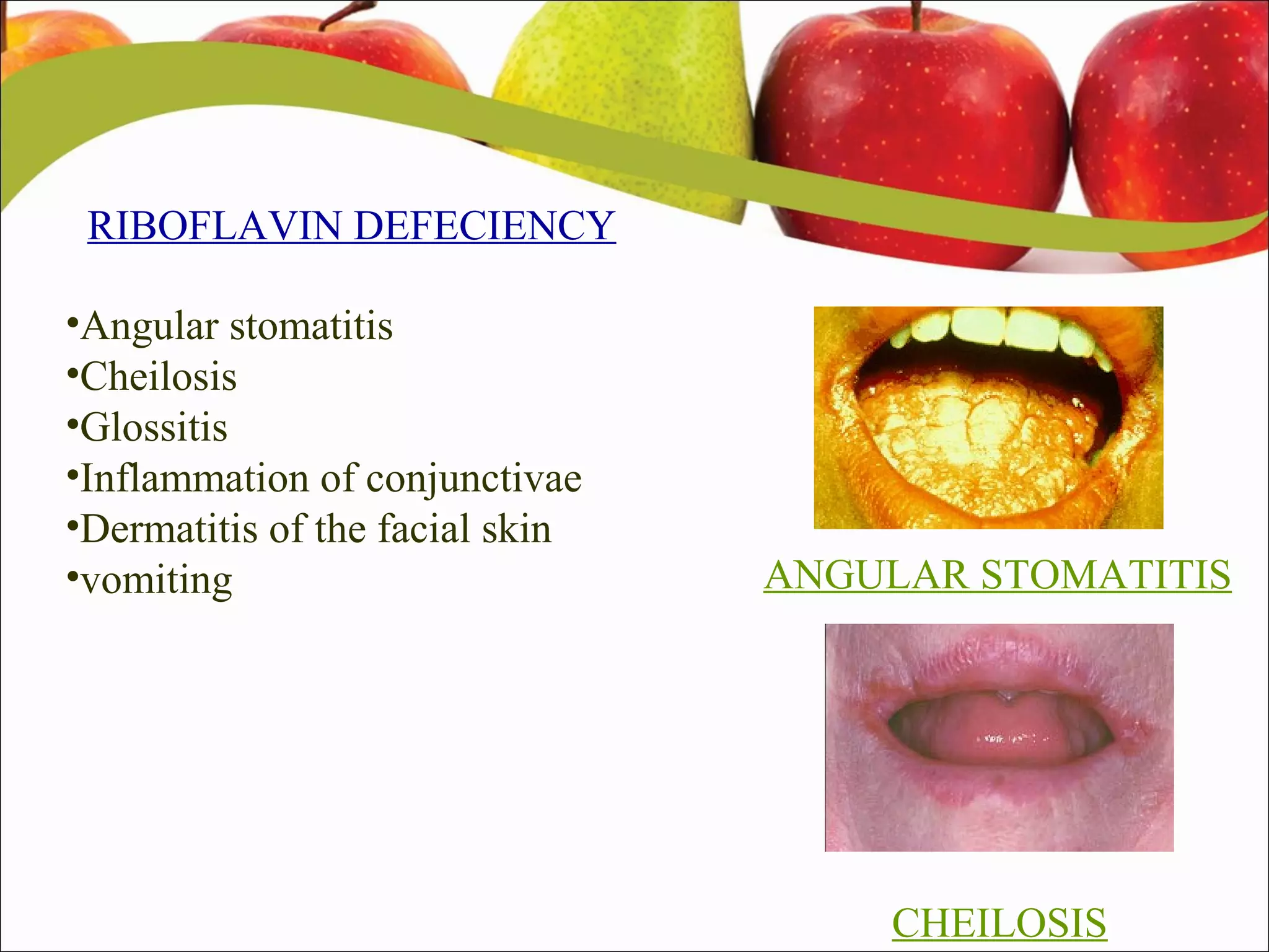 Diet and nutrition | PPT