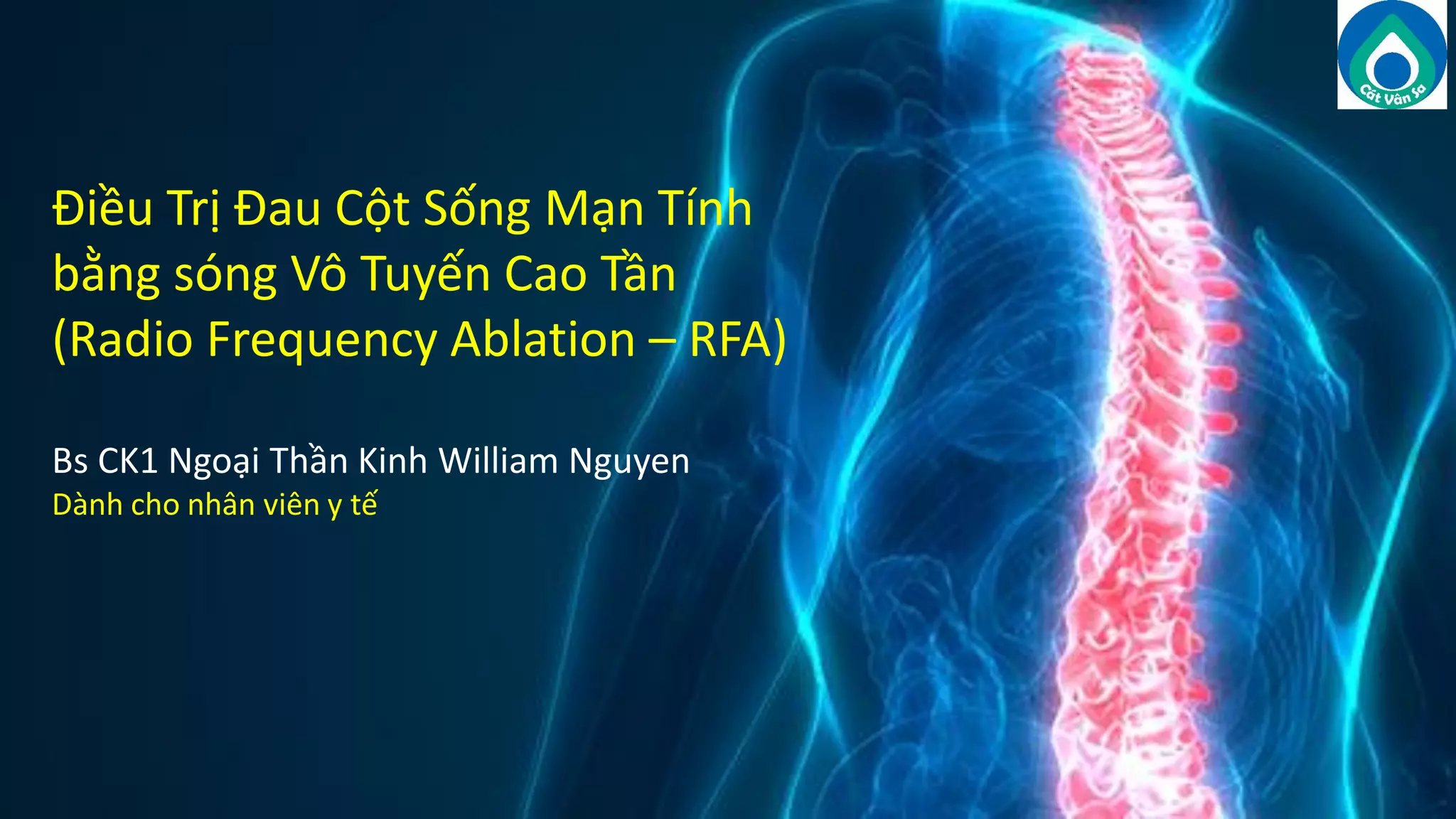 Điều Trị Đau Cột Sống Mạn Tính bằng Sóng Vô Tuyến Cao Tần RFA (Rafio Frequency Ablation for ...
