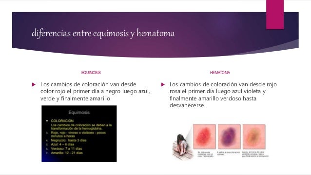 Equimosis O Hematoma