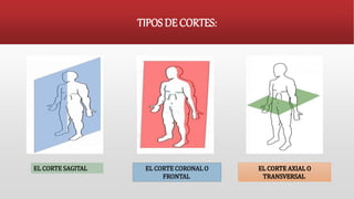 DIFERENCIA ENTRE LOS PLANOS ANATÓMICOS.pptx