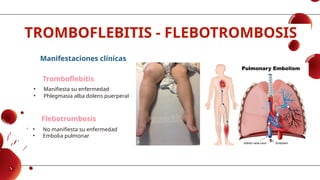 Diferencias flebotrombosis y tromboflebitis.pptx