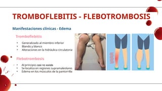 Diferencias flebotrombosis y tromboflebitis.pptx
