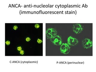 Differential diagnoses of bronchial asthma | PPT