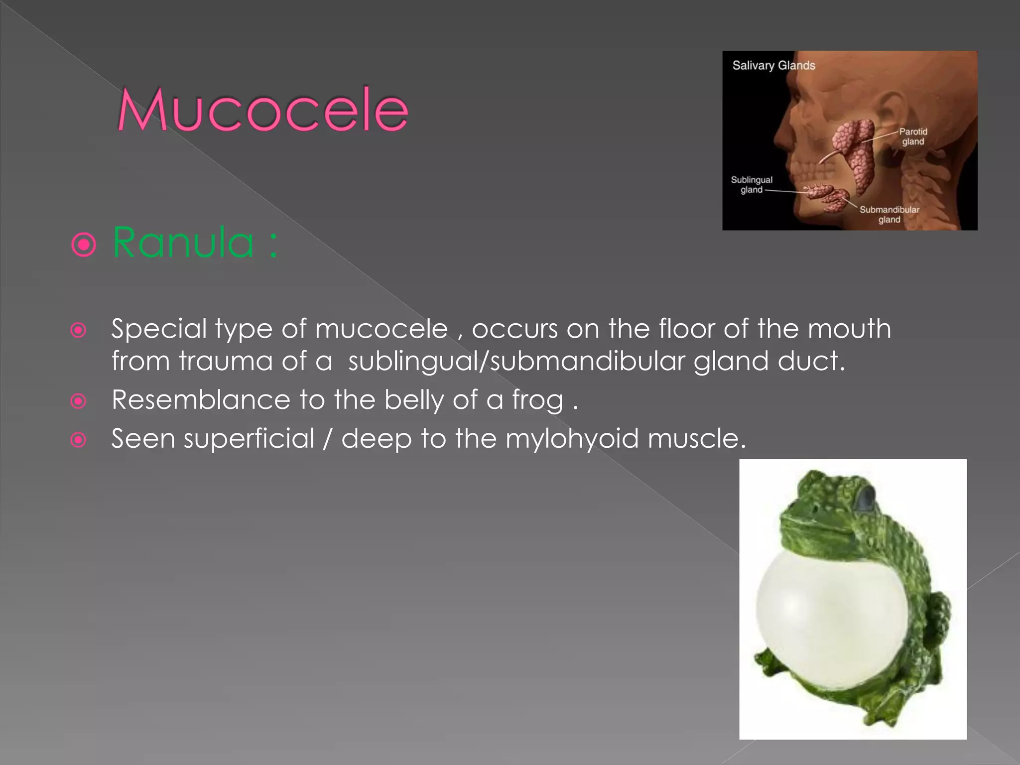 Differential Diagnosis of Salivary Gland Lesions | PDF