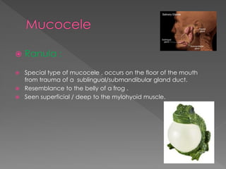 Differential Diagnosis of Salivary Gland Lesions | PDF