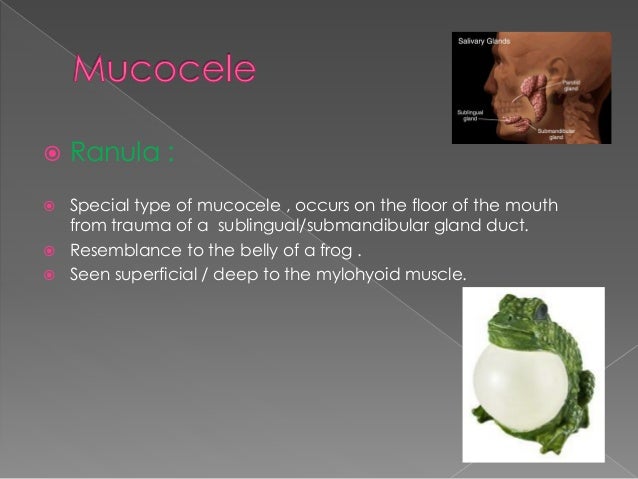 Differential Diagnosis of Salivary Gland Lesions