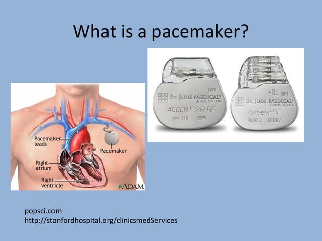 Difference between a pacemaker and an icd presentation | PPT