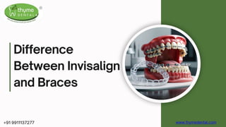 Difference Between Invisalign and Braces- Thyme Dental.pptx | Dental Health | Diseases and ...