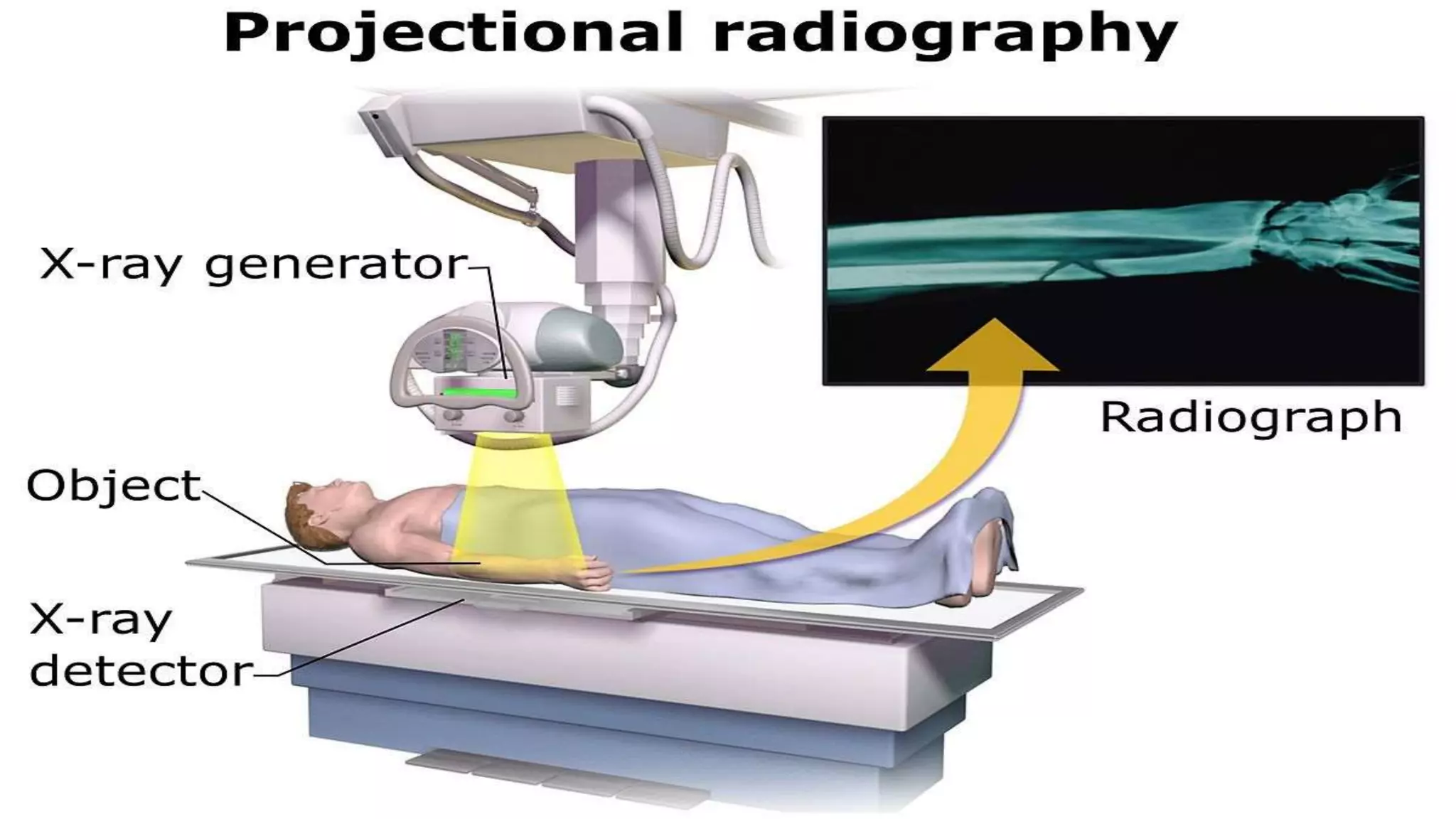 Difference between modalities of general radiology and nuclear medicine ...