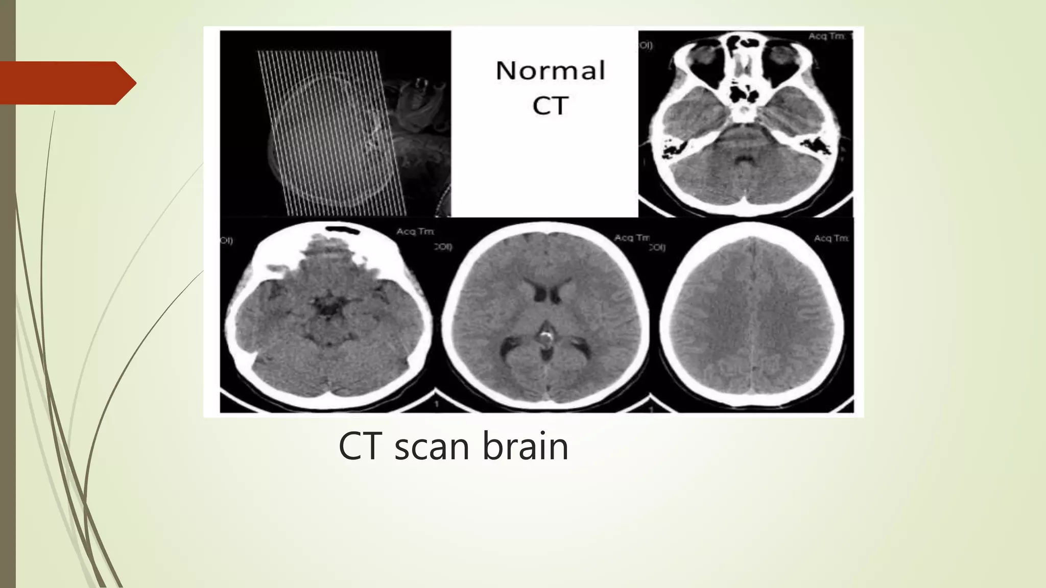 Difference between modalities of general radiology and nuclear medicine ...