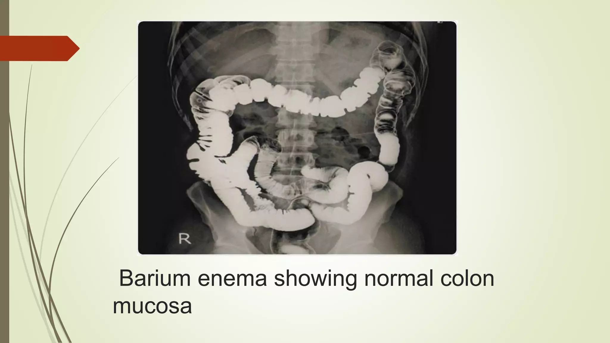 Difference between modalities of general radiology and nuclear medicine | PPTX