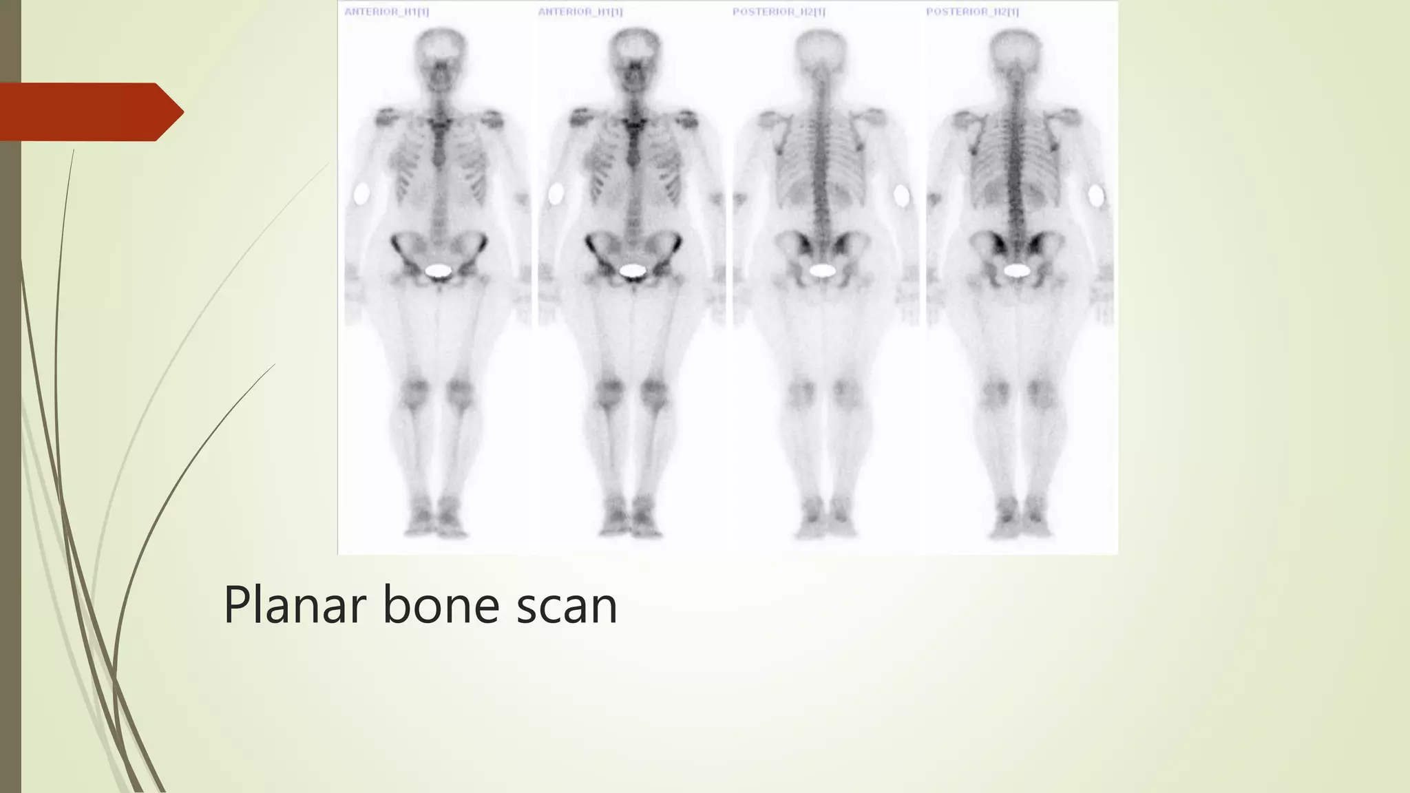 Difference between modalities of general radiology and nuclear medicine ...