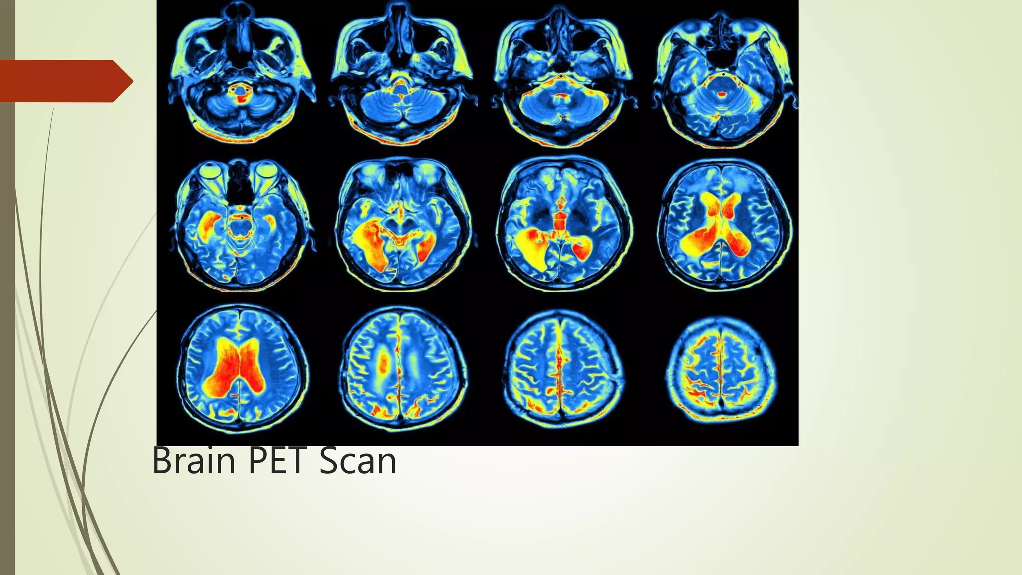 Difference between modalities of general radiology and nuclear medicine | PPTX