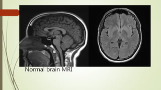 Difference between modalities of general radiology and nuclear medicine | PPTX