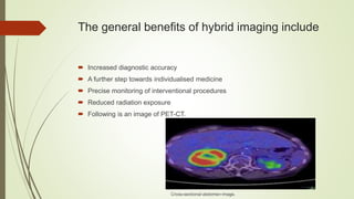 Difference between modalities of general radiology and nuclear medicine ...