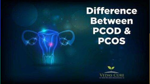Difference between pocd and pocs | PPT