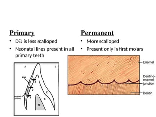 Difference between primary and permanent.ppt