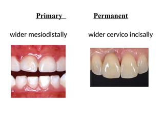 Difference between primary and permanent.ppt