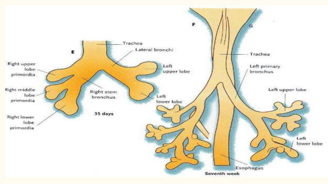 Differences b-w Adult & pediatric lungs.pptx | Lung and Respiratory ...