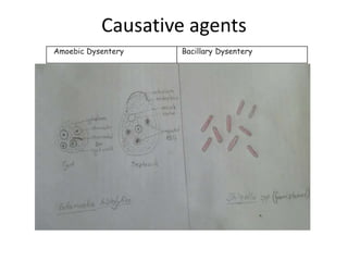 Differences between amoebic and bacillary dysentery | PPTX