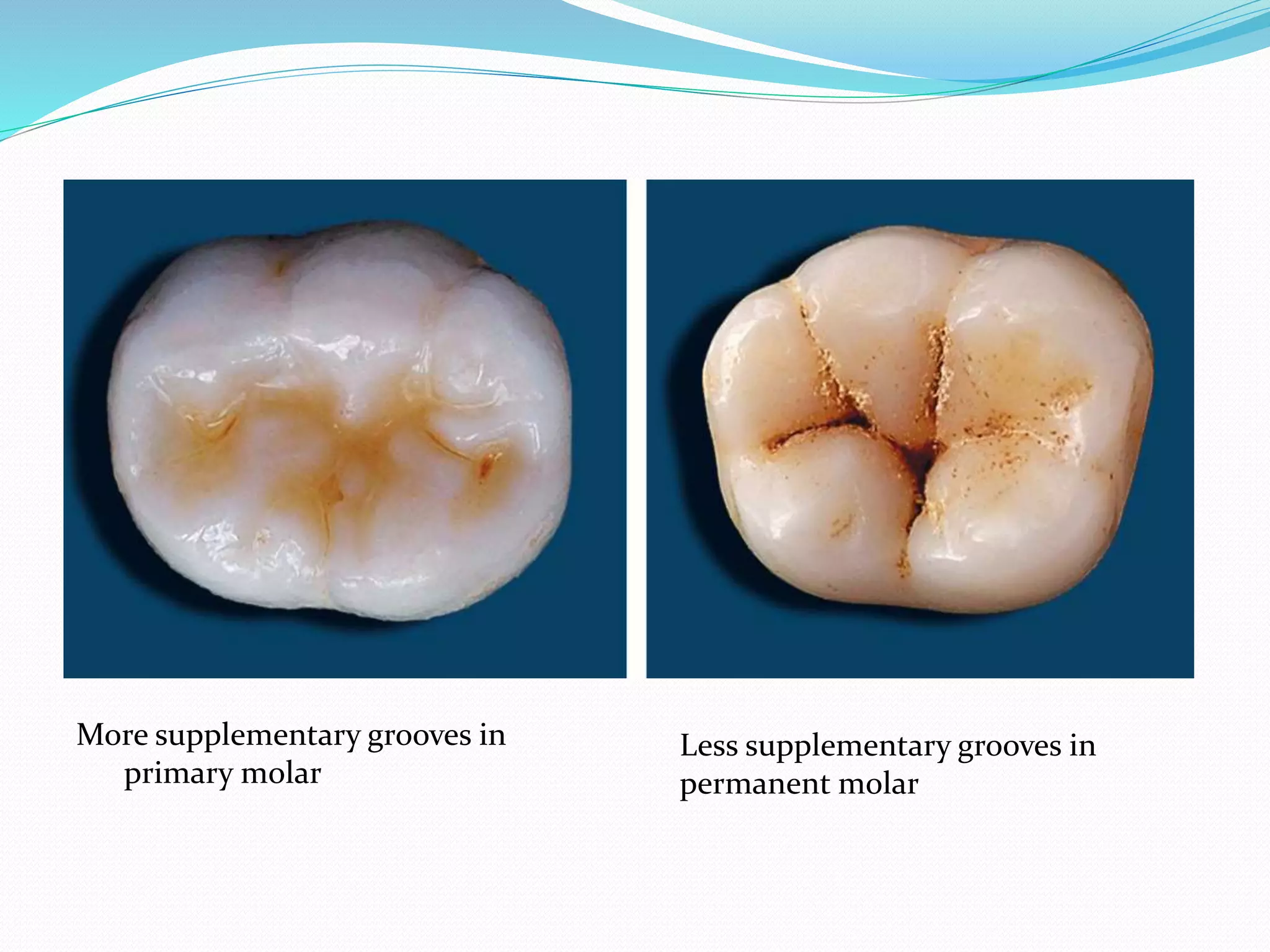 Differences between primary and permanent dentition | PPTX