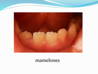 Differences between primary and permanent dentition | PPTX