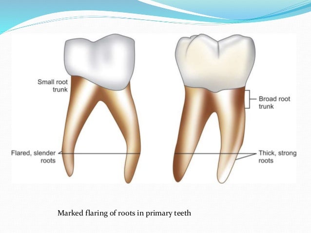 Differences between primary and permanent dentition