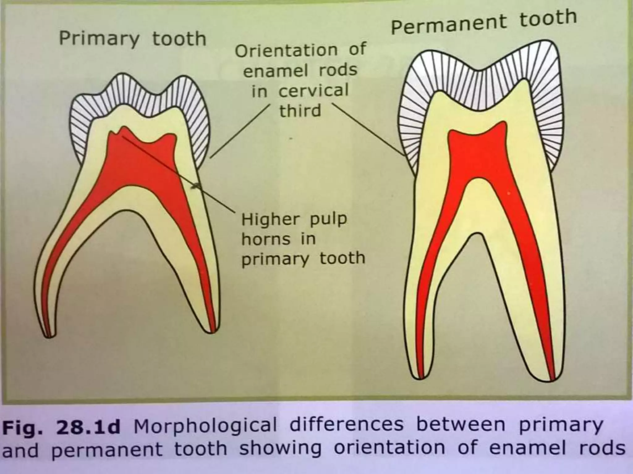 Differences between primary and permanent teeth | PPTX