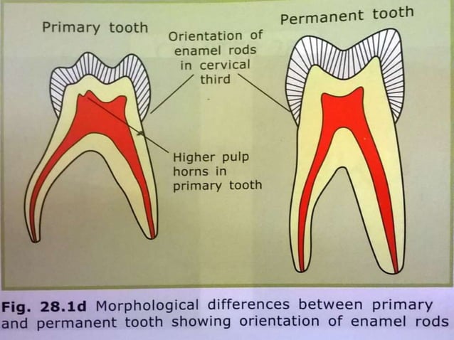 Differences between primary and permanent teeth | PPTX