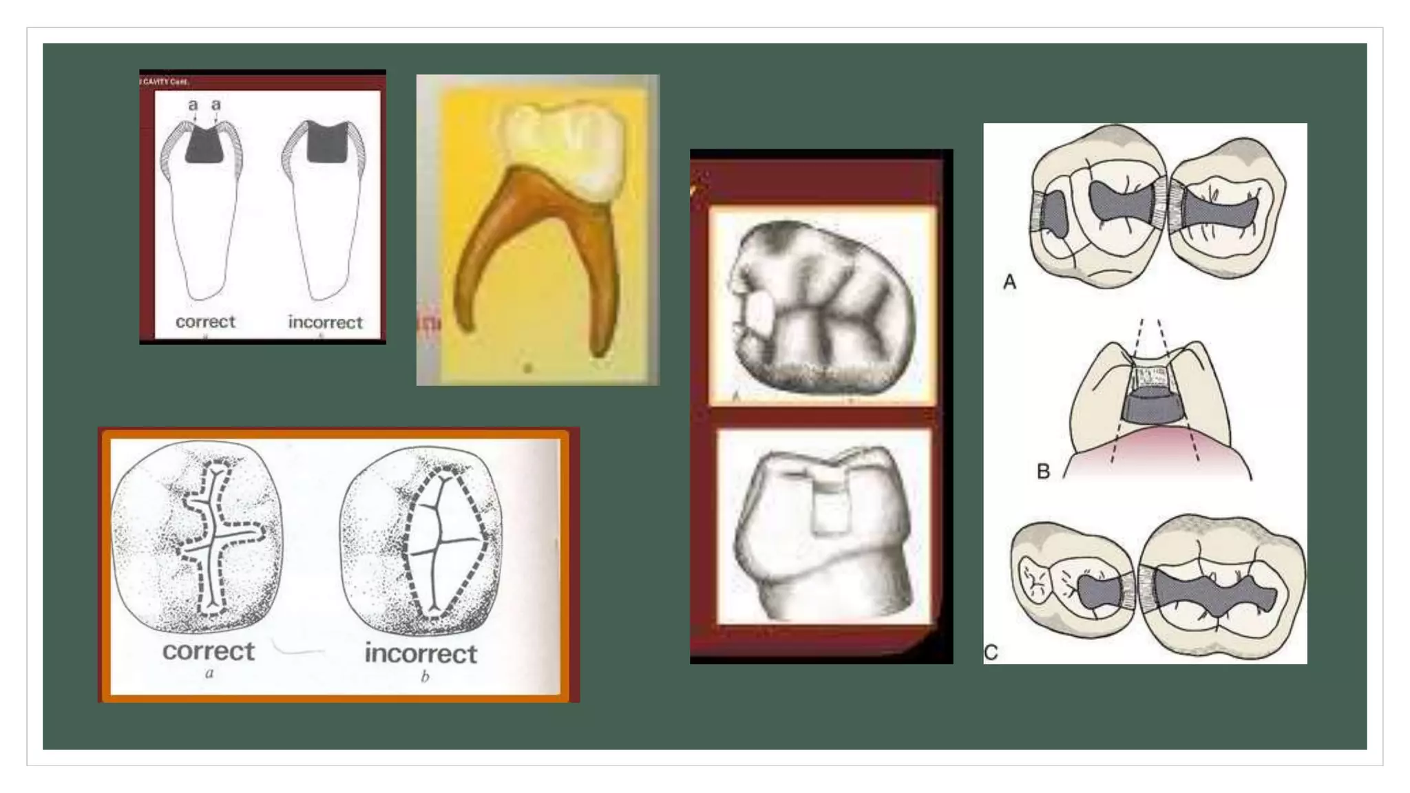 Differences between primary and permanent teeth and importance | PPTX
