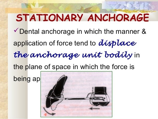 Different anchorage systems in orthodontics