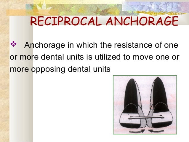 Different anchorage systems in orthodontics