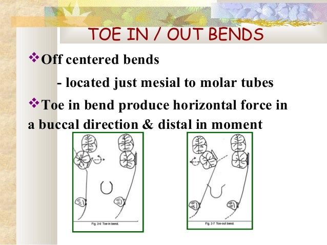 Different anchorage systems in orthodontics