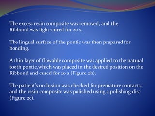 Different clinical applications of bondable reinforcement ribbond in ...