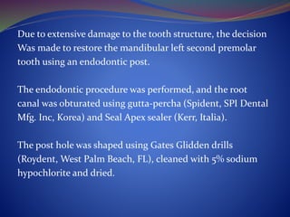 Different clinical applications of bondable reinforcement ribbond in ...