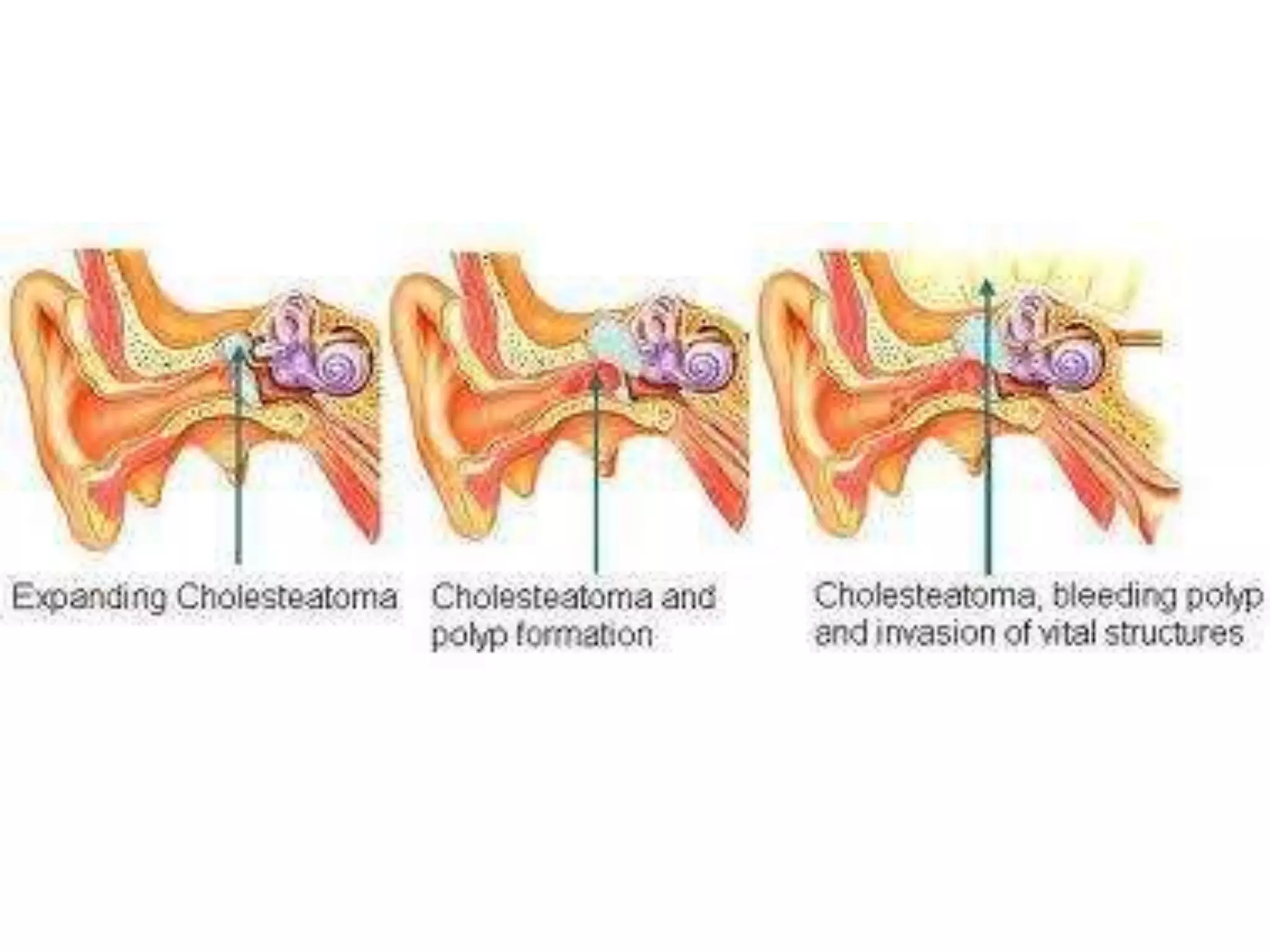 Different ear condition | PPT