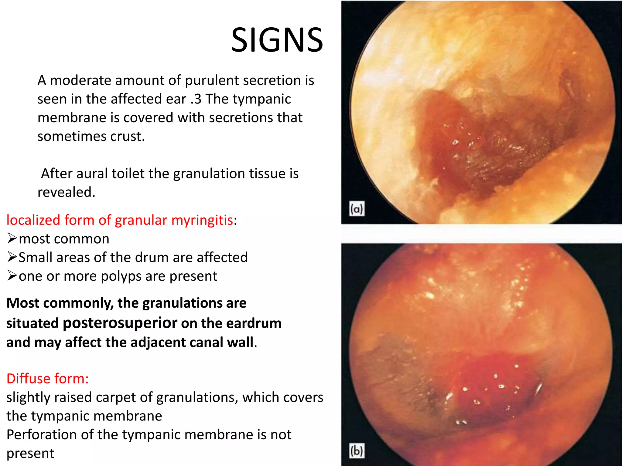 Different ear conditions | PPTX