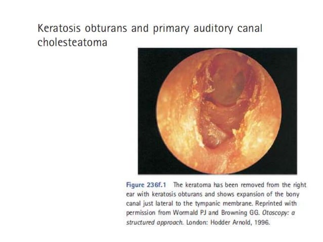 Different ear conditions | PPTX | Ear, Nose and Throat Conditions ...