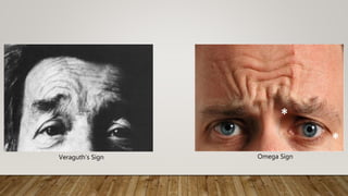 Different faces of depression | PPTX