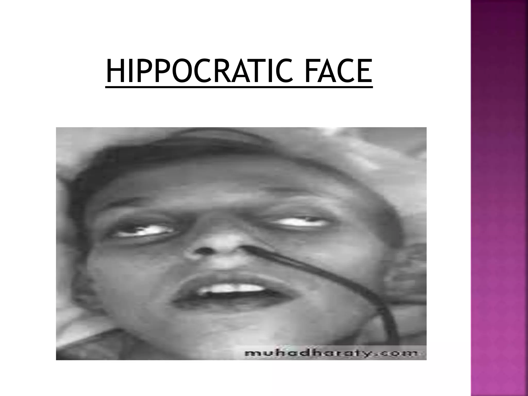 Different facies used in the diagnosis of disease | PPT