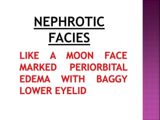 Different facies used in the diagnosis of disease | PPTX